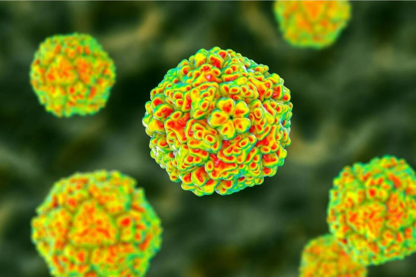 ¿Vuelve la Polio? Un virus similar que paraliza a los niños parece ...