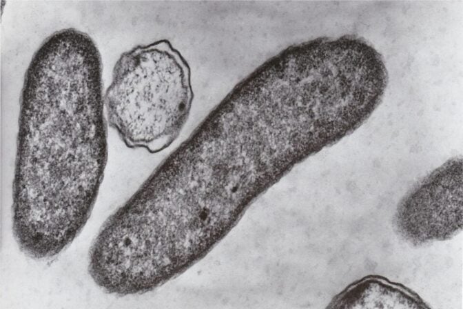 Un adolescente lucha por su vida tras enfermar por la bacteria ...